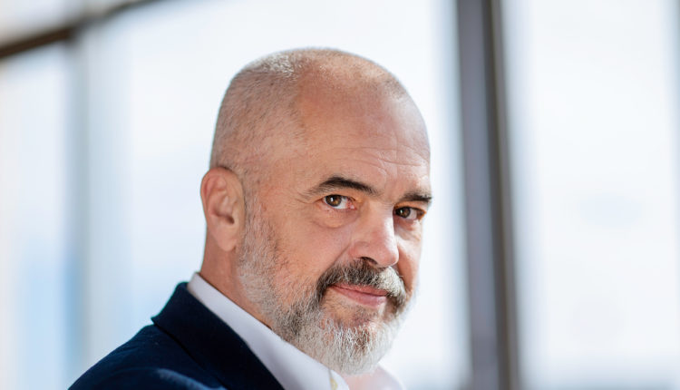 Edi Rama operohet nga “zora qorre” – Tetova Sot Edi Rama operohet nga “zora qorre” – Tetova Sot