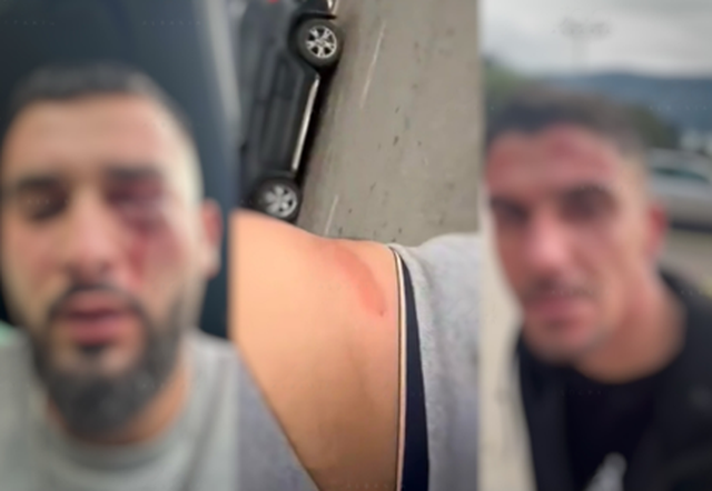U dhunuan barbarisht në Mal të Zi, zbardhet identiteti i tre të rinjve ... U dhunuan barbarisht në Mal të Zi, zbardhet identiteti i tre të rinjve ...