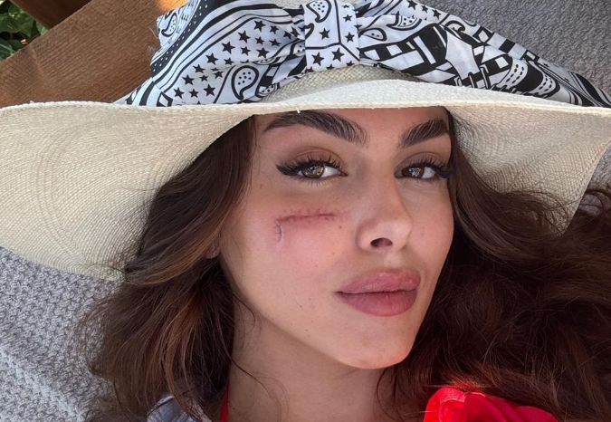 Klea Prenga publikon fotografi të reja në Instagram, plaga ende e ...